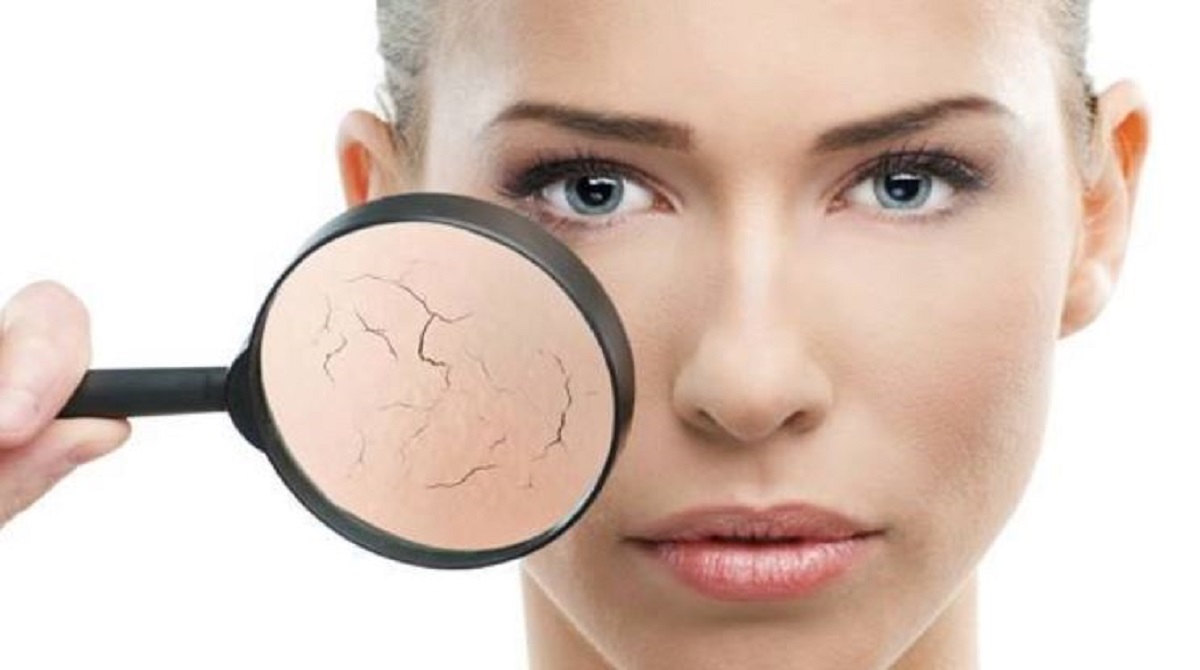 Rimedi in caso di pelle secca, squamosa o opaca - Physiogel